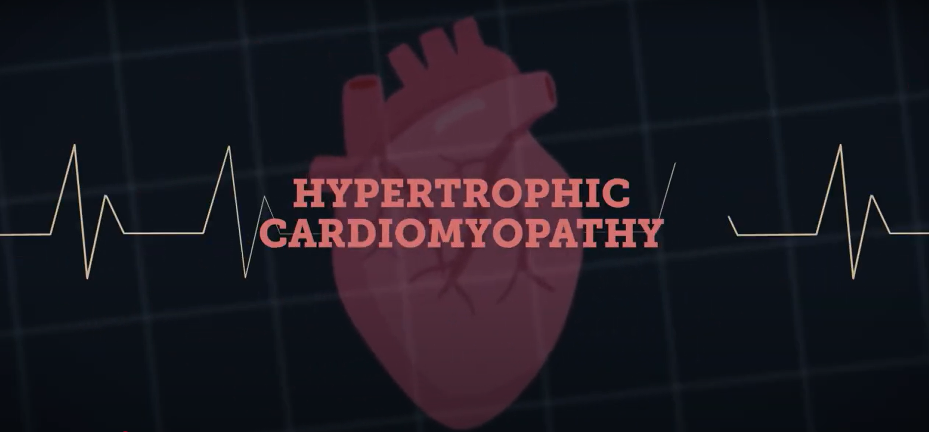 What is HCM? - Alliance for Patient Access